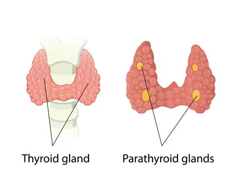 Hyperparathyreoïdie Versus Hyperthyreoïdie Wat Zijn De Verschillen Med Nl