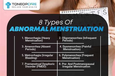 8 Common Menstrual Irregularities Causes Treatment Options