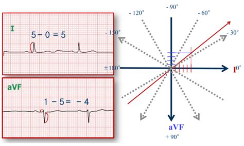 심전도 판독의 기본 Metamedic