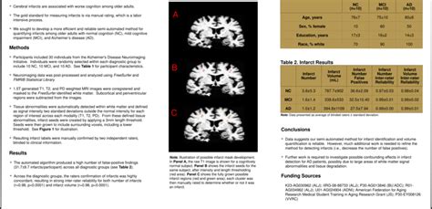 Infarct Detection Protocol Download Scientific Diagram