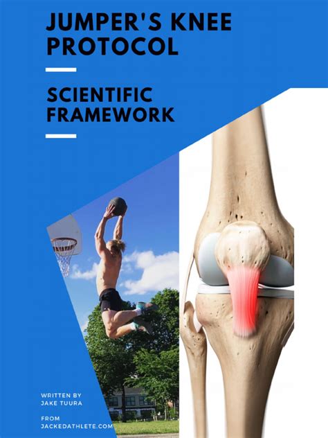 Jumpers Knee Protocol Scientific Framework Pdf Tendon Knee