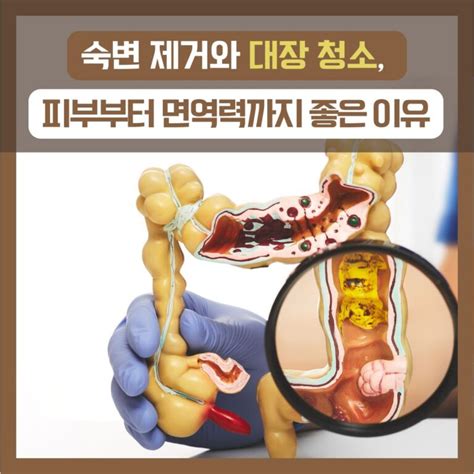 숙변 제거와 대장 청소 피부부터 면역력까지 좋아지는 방법 내몸내손 자가치유노트