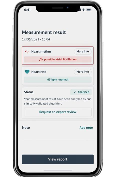 Chapter 9 The Difference Between Consumer Grade Ppg And Fibricheck Ppg Fibricheck Academy