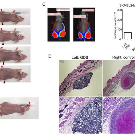 Gds Prevented Tumor Seeding In Biopsy Of Subcutaneous Gl261 Tumor A Download Scientific