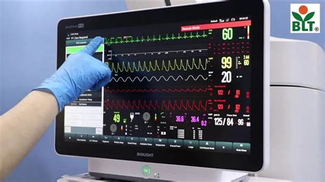 Biolight P18 Patient Monitor Display Size 18 5 Inch Led At Best Price In Chennai