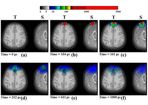 The Photon Migration In The Horizontal Cross Section The Dynamics Of Download Scientific