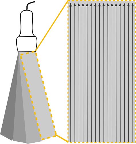 Figure 1 From Right Ventricular Flow Dynamics In Dilated Right Ventricles Energy Loss