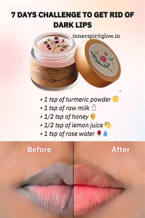 Days Challenge To Get Rid Dark Lips Get Rid Dark Lips Lip Care Routine Beginner Skin Care