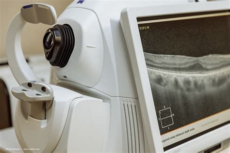 Multimodal Imaging Offers An Added Perspective On Progression Of Amd