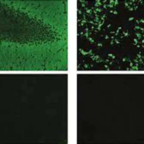 Anti N Methyl D Aspartate Receptor Cost In Delhi Test Price Near Me India Gdic