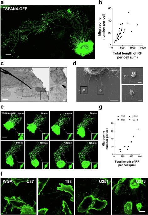 Glioblastoma Derived Migrasomes Promote Migration And Invasion By Releasing Pak4 And Lama4