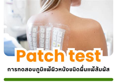 หมดปัญหาผื่นแพ้แบบไร้สาเหตุ เริ่มต้นด้วย “patch test” ศูนย์บริการทาง