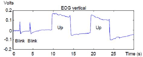 B Eye Movement And Blinking Detection Vertical Eog Download