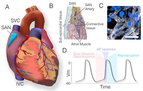 Characteristics Of Sinus Node Arrhythmias