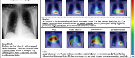Figure 2 From Automatic Radiology Reports Generation Via Memory