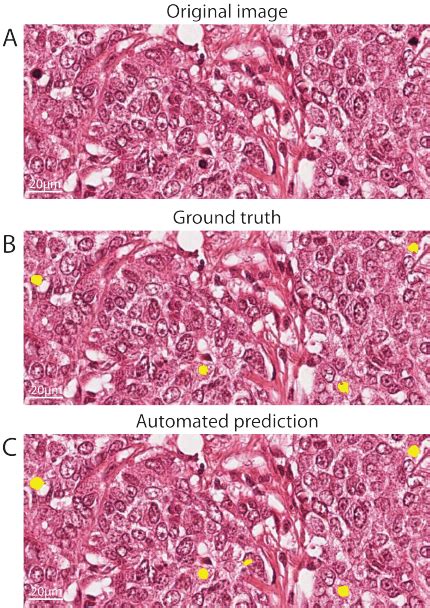 Mitotic Cell Detection Overlayed On Test Image A Raw Data B Download Scientific Diagram