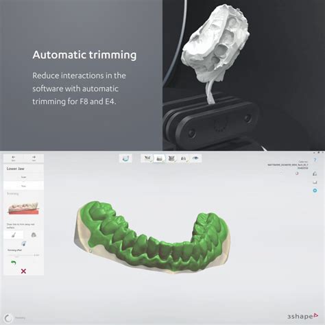 E4 Lab Scanner 💻 디지털의 강점을 극대화하기 💡 클리닉의 아날로그 케이스를 디지털 워크플로로 연결하기 🖱️ 진보한 Cad 솔루션으로 디자인하기 3shape