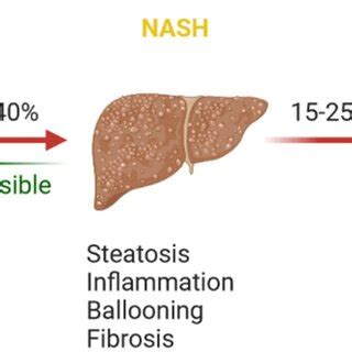 NAFL Spectrum During Development And Progression In Healthy Livers Download Scientific
