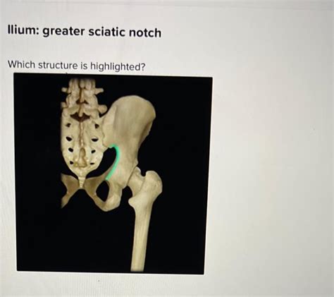 Solved Ilium Greater Sciatic Notch Which Structure Is