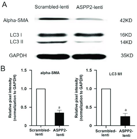 Western Blot Analysis Of Alpha Sma And Lc3 Ii I In Retinas Of Rats