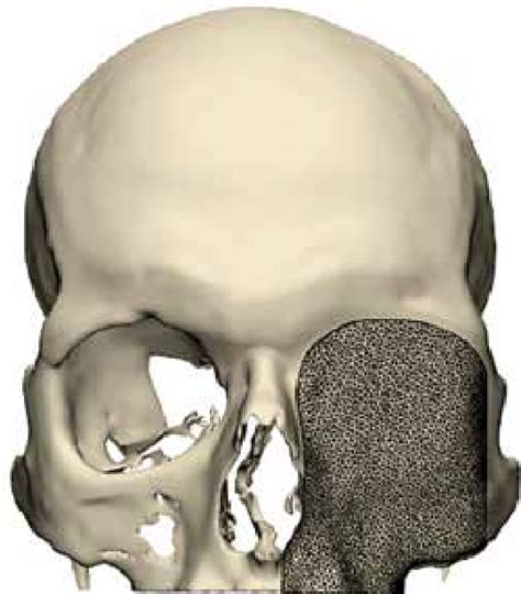Diagram Of Resection Type Iv Download Scientific Diagram