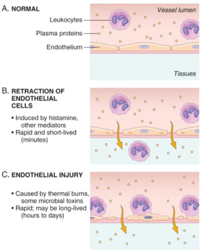 Revise The Pathology And Pathophysiology Of The Acute Inflammatory Reaction A Normal Response
