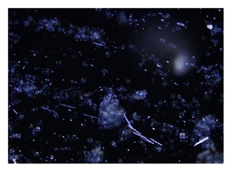 Needle Shaped Impurities And Raphides In Radix Ampelopsis Japonica Download Scientific Diagram