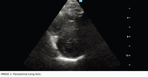 The Intersections Of Physical And Mental Health Disorders Acep Now