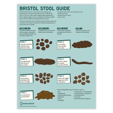 Bristol Stool Chart Poster Illustrated Bowel Health Chart Anatomystuff