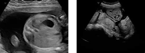 Figure 1 From Visualising Spatio Temporal Gaze Characteristics For Exploratory Data Analysis In