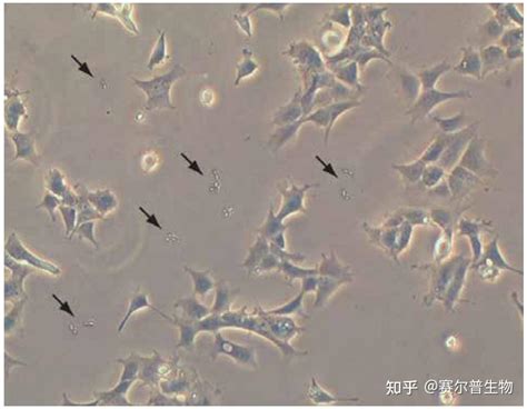 总结 6种细胞培养生物污染物常见类型 知乎