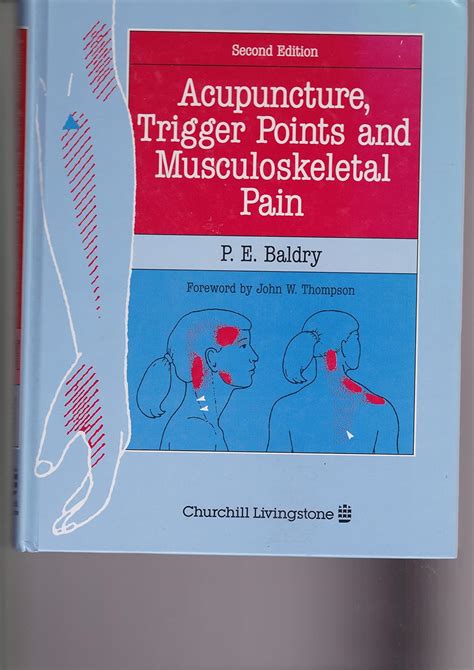 Acupuncture Trigger Points And Musculoskeletal Pain A Scientific
