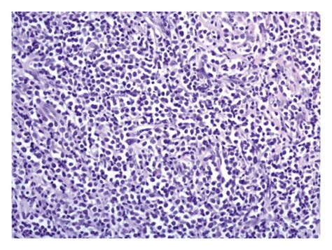 A The Dissected Neck Lymph Nodes Were Conglomerated B Normal Download Scientific Diagram