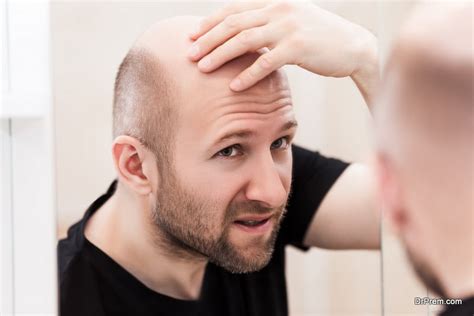 How To Deal With Baldness Live A Great Life Guide Coaching With Dr Prem Team Carve Your Life