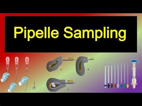 Pipelle Sampling Or Pipelle Endometrial Sampling TOACS And OSCE Station YouTube