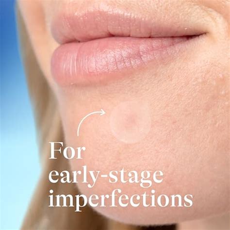 Differin Acne Patches Pimple Patches For Acne Prone Skin Formulated With Salicylic Acid And Differin Acne Patches Pimple Patches For Acne Prone Skin Formulated With Salicylic Acid And