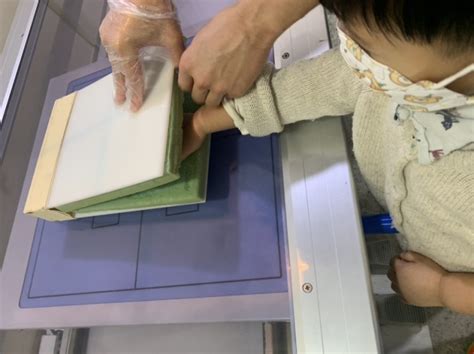 소아 미세골절 의심으로 소아정형전문의 치료 받고 온 후기 네이버 블로그