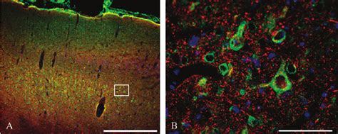 Nogo A Is Expressed On Layer V Pyramidal Neurons In Cortical Area FL In Download Scientific