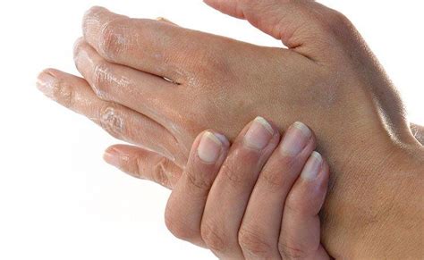 Peripheral Neuropathy Hands