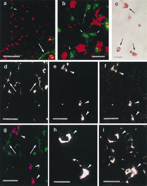 Macrophage Migration From Skin To Draining Lymph Nodes Upon Ag