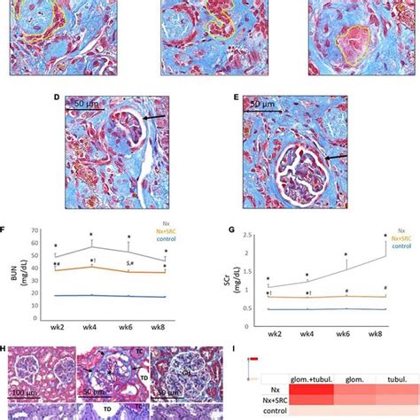 renal expression of selected renal cell src genes and their