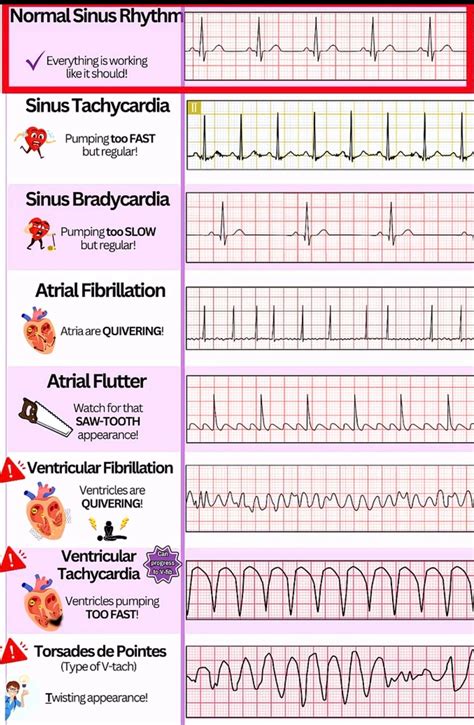 Best 13 38 Pages Easy Ekg And Master The Basics Like Heart Blocks Help With Junctional Rhythms