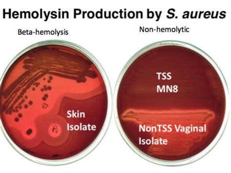 1 8 Staphylococcus Aureus Flashcards Quizlet