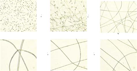Different Fiber Morphologies Of Electrospun Nanofibers Produced From