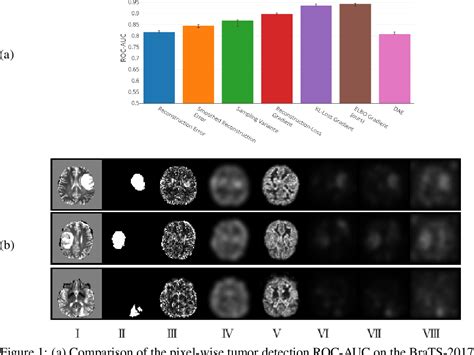 Figure 1 From A Case For The Score Identifying Image Anomalies Using Variational Autoencoder