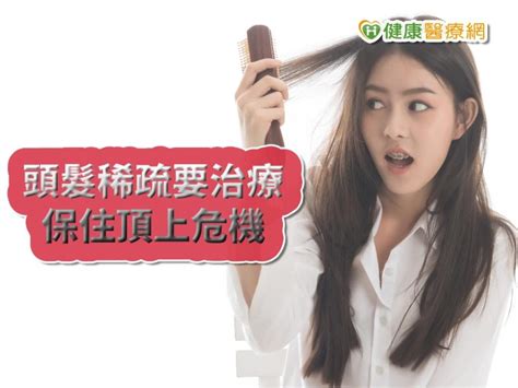 頭髮日漸稀疏怎麼辦？ 皮膚科醫師教你保養、治療 指傳媒