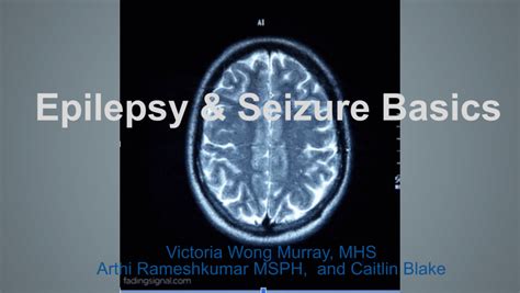 PDF Epilepsy Seizure Basics