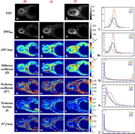 14 Years Old Male Patient From Good Response Group With Localized
