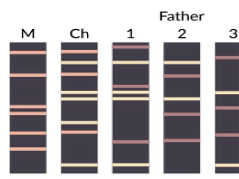 Forensic Dna Profiling Pptx Genealogy And Ancestry Hobbies And Interests