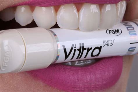 Why Should You Have A Single Shade Composite Fgm Dental Group